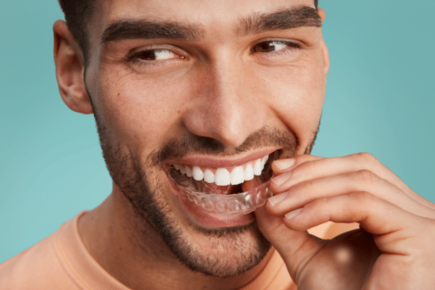 Dr SMILE : les aligneurs dentaires qui corrigent le sourire